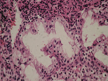MICROSCOPIC HISTOLOGY IMAGES - FEMALE REPRODUCTIVE SYSTEM - UTERUS ...